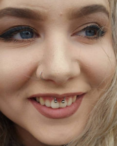 Frenulum Piercing – A Complete Expert Guide!